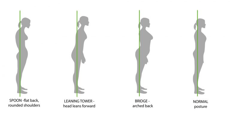 Poor Posture Makes you More Susceptible to Injuries | PhysioRoom